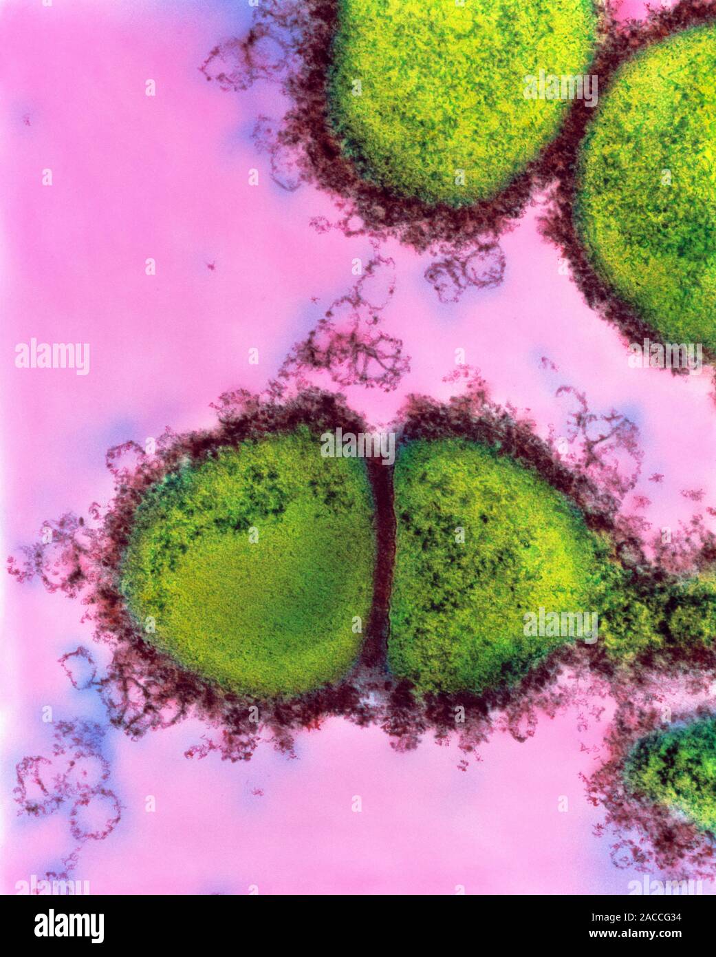 Streptococcus pyogenes bacteria. Coloured trans- mission electron ...