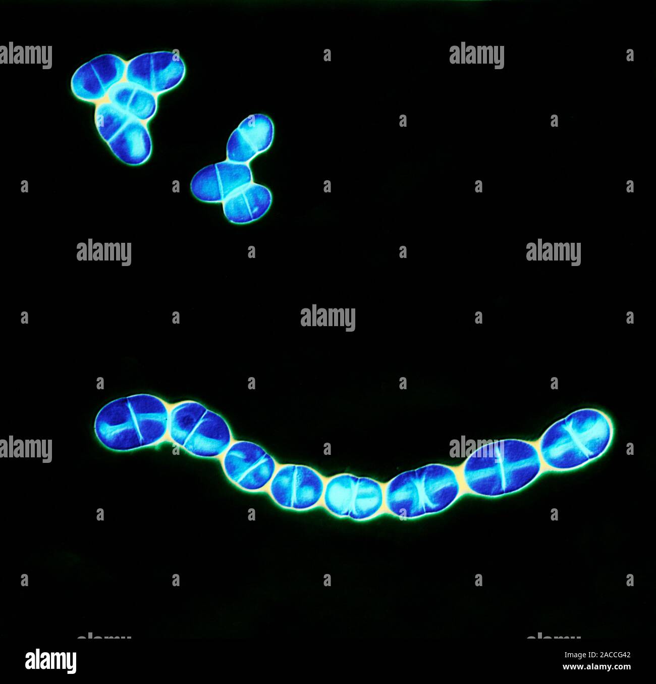 Streptococcus mutans bacteria. Coloured transmission electron ...