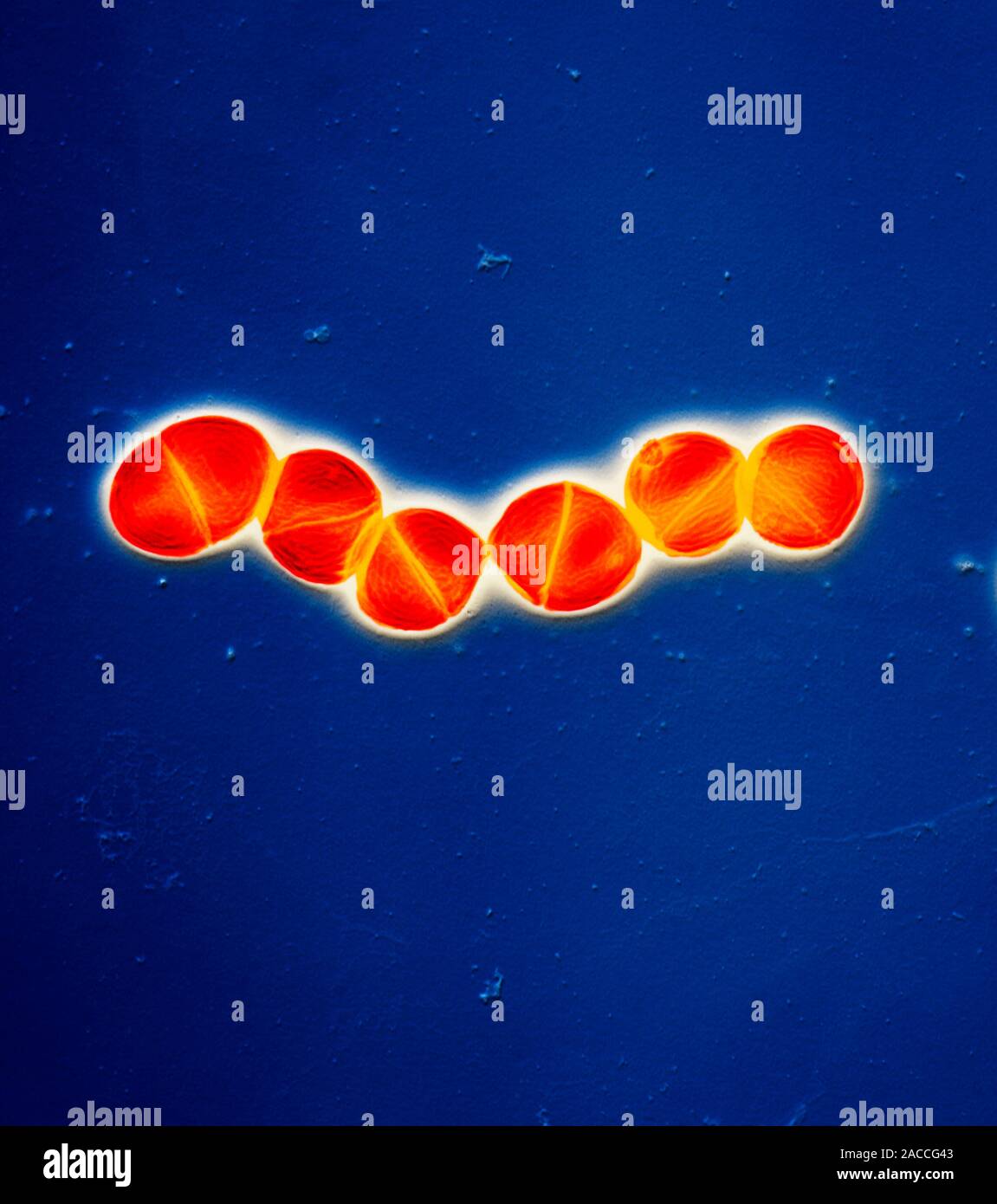Streptococcus pneumoniae, coloured transmission electron micrograph ...