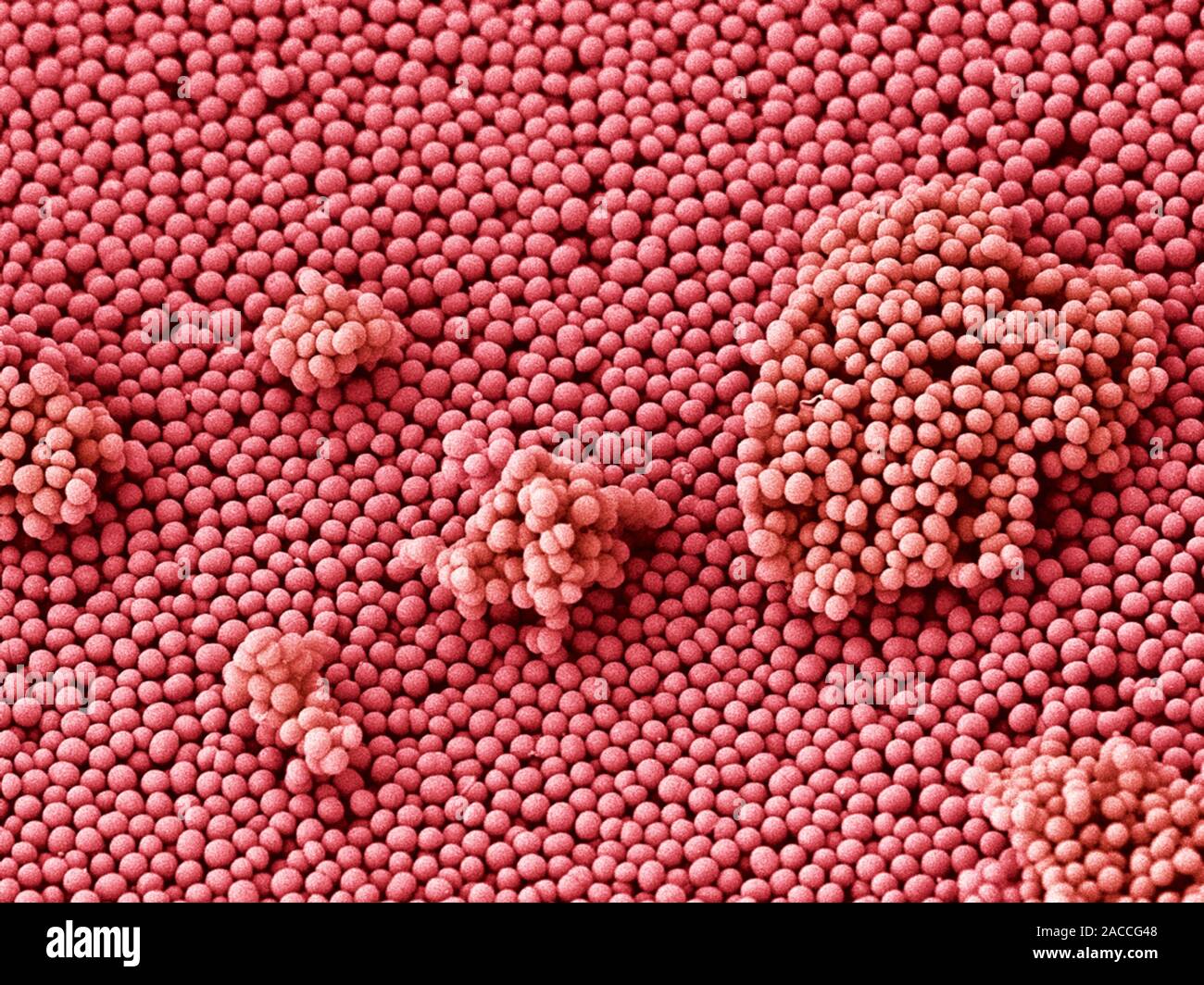 Streptococcus bacteria. Coloured scanning electron micrograph (SEM) of ...