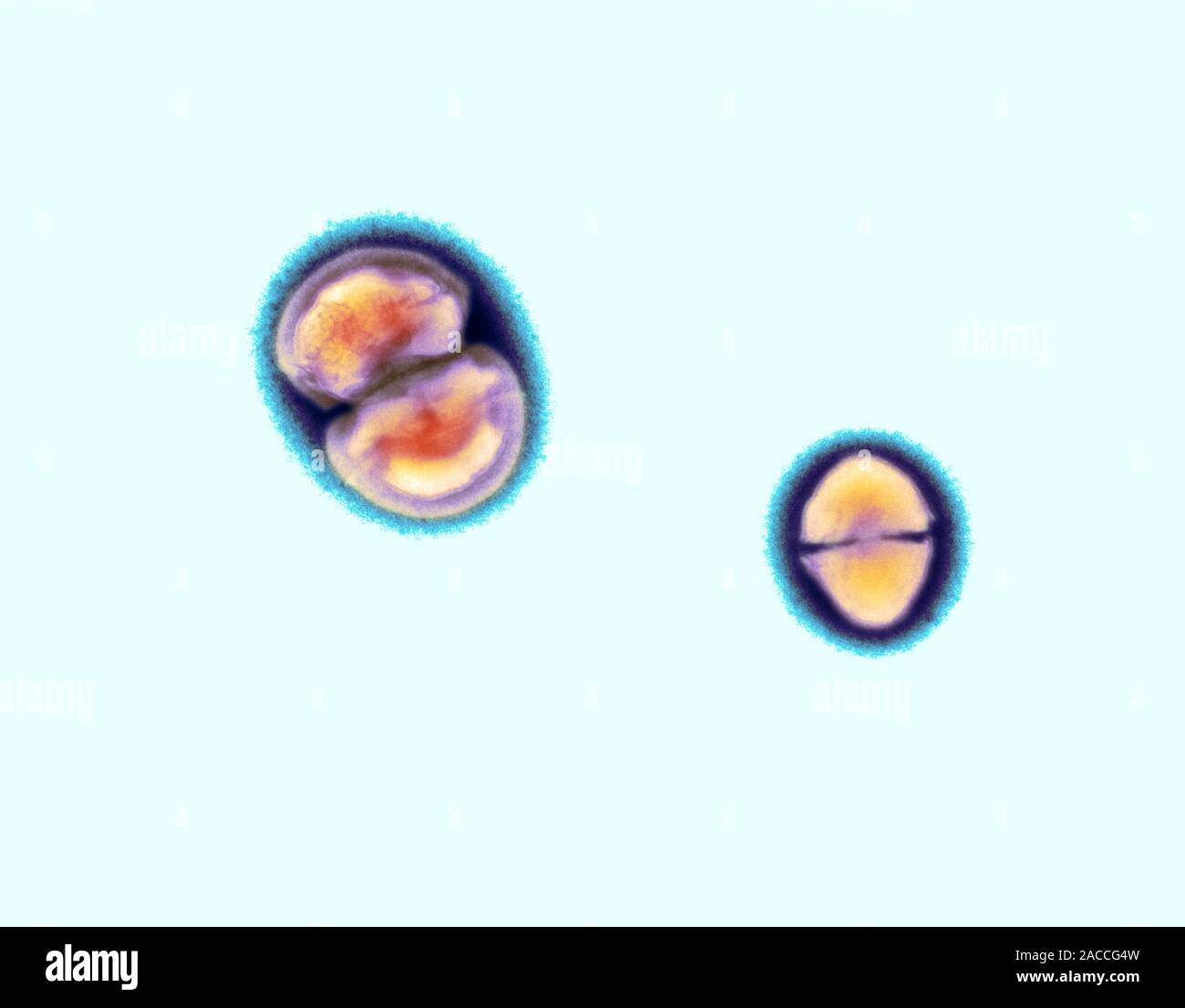 Streptococcus oral bacteria. Coloured transmission electron micrograph ...