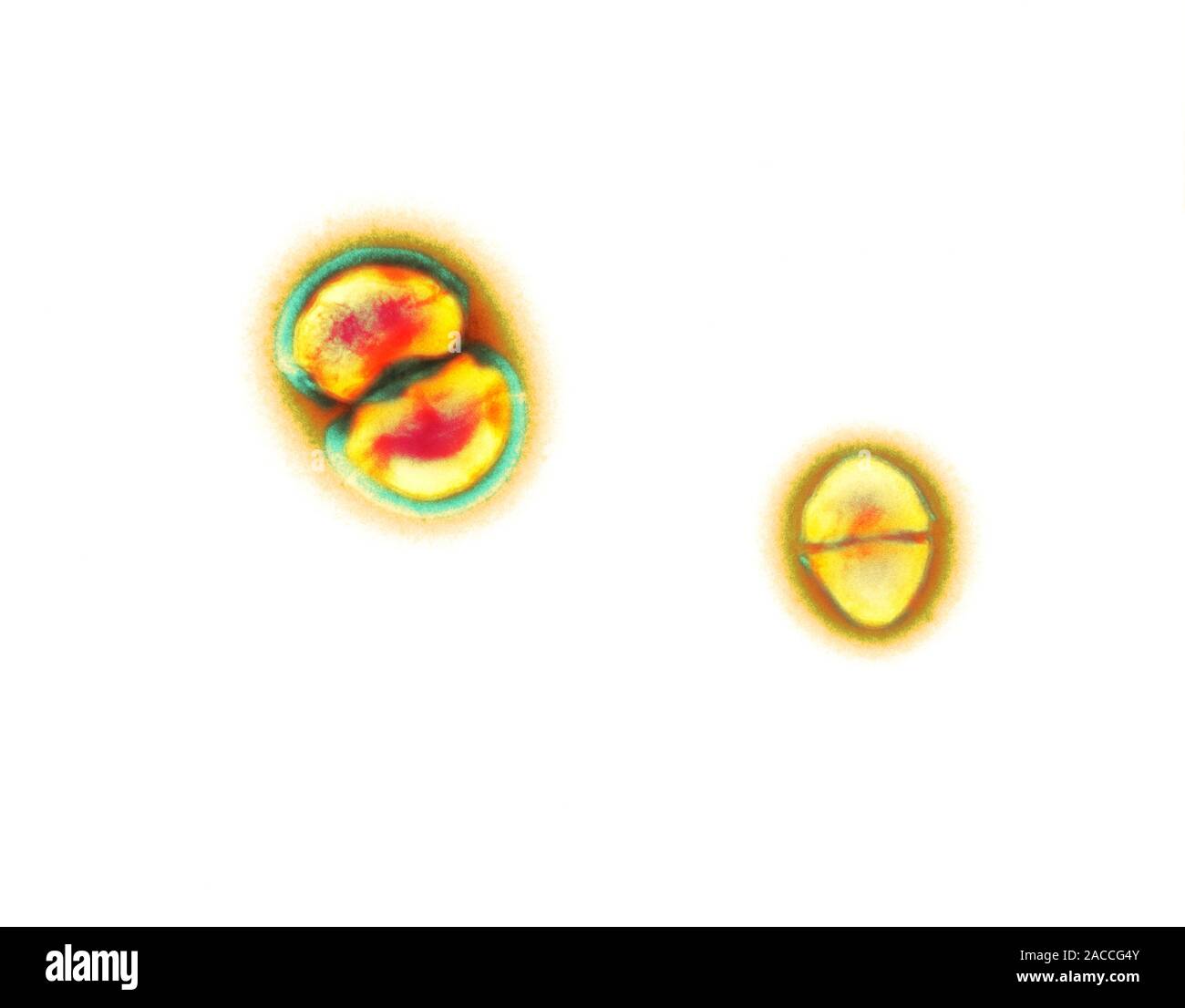 Streptococcus Oral Bacteria Coloured Transmission Electron Micrograph Tem Of Two