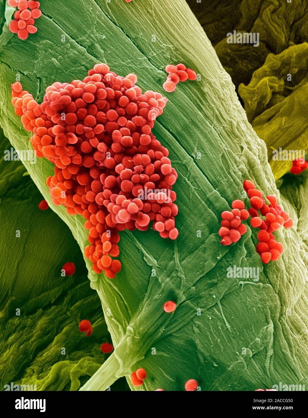 Streptococcus pneumoniae, coloured scanning electron micrograph (SEM ...