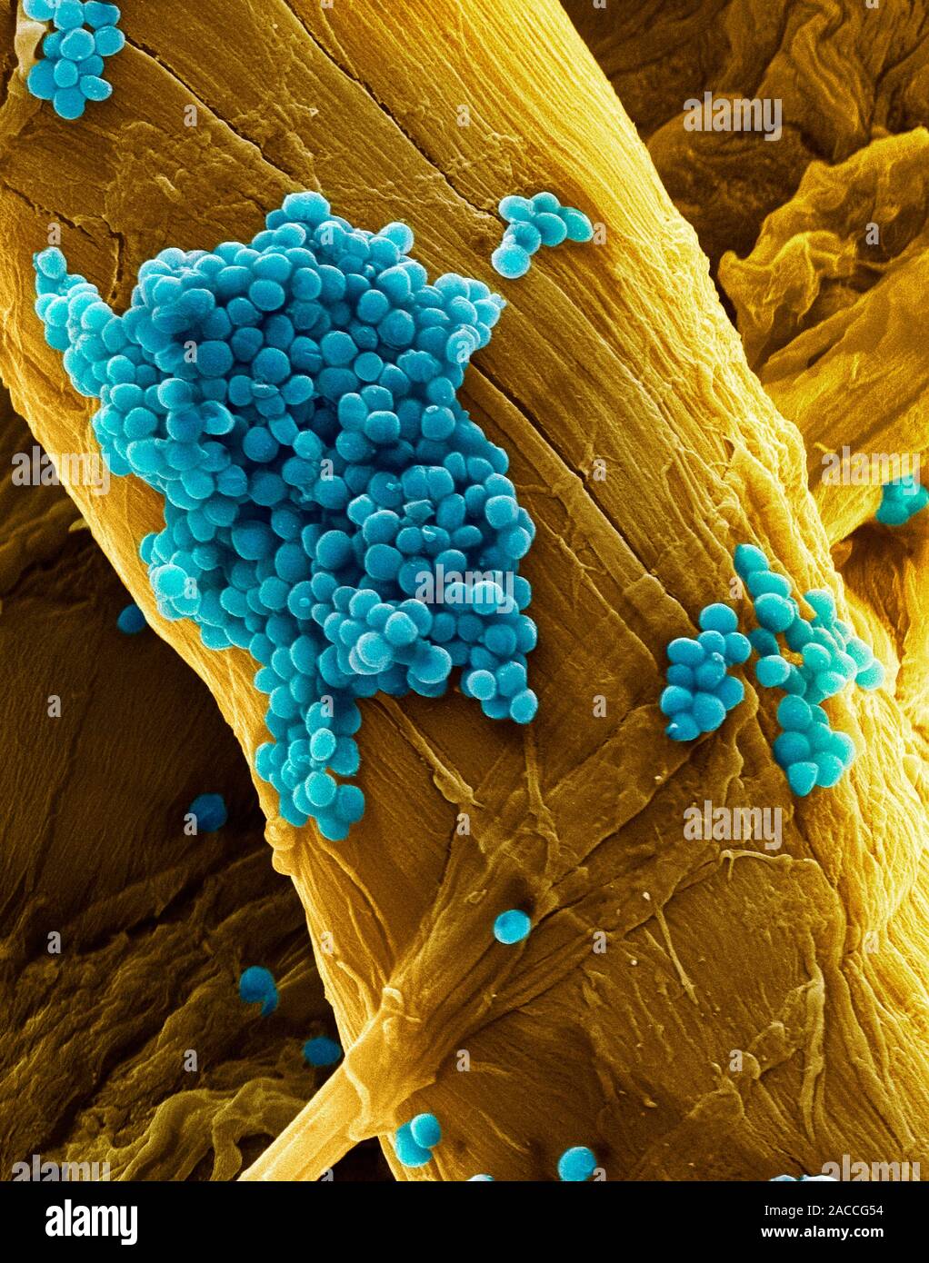 Streptococcus pneumoniae, coloured scanning electron micrograph (SEM ... Streptococcus pneumoniae, coloured scanning electron micrograph (SEM ...
