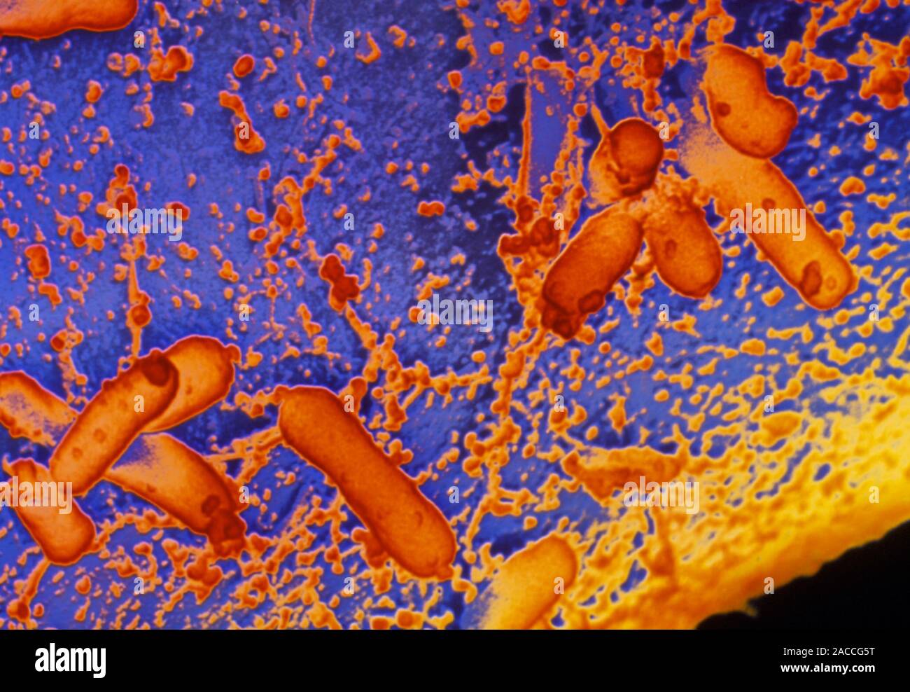 False-colour scanning electron micrograph (SEM) of nitrogen-fixing ...