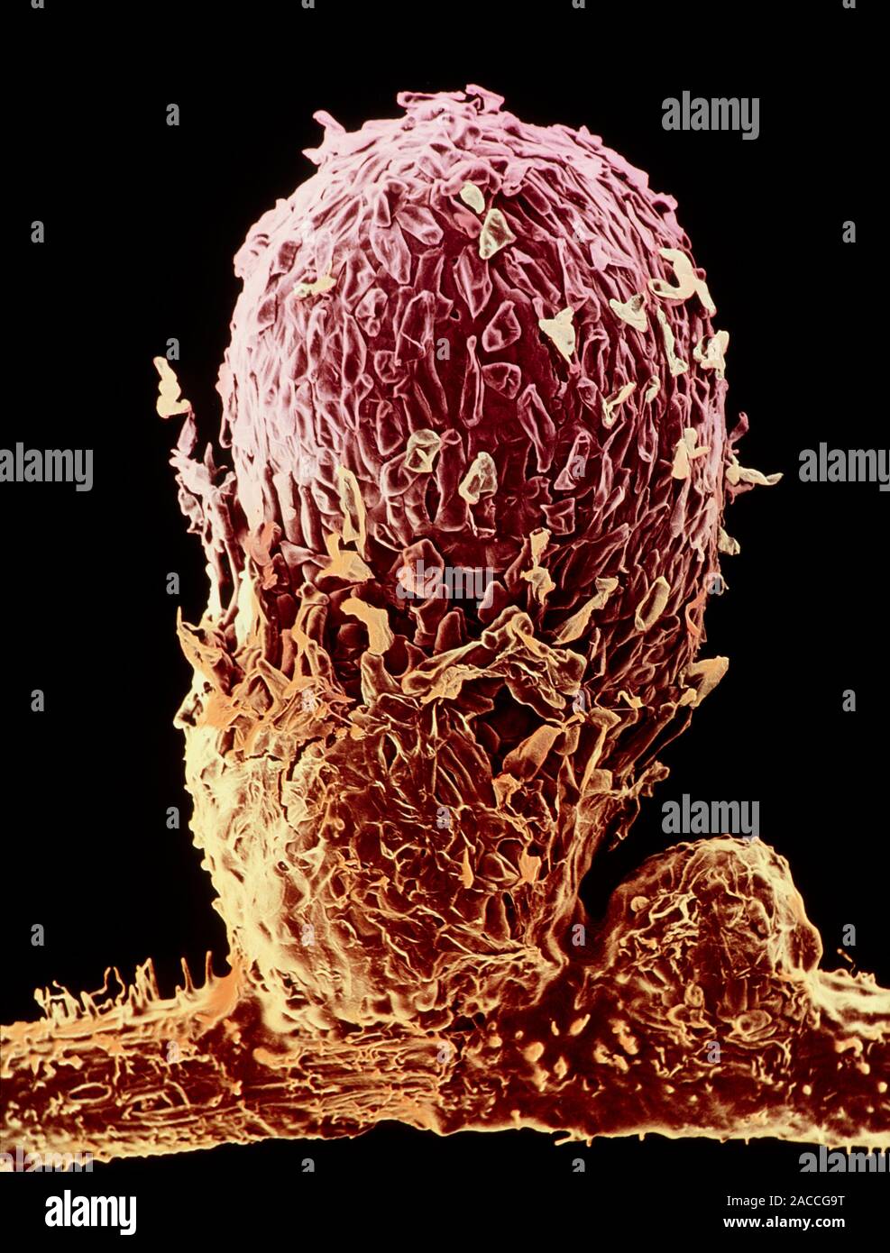 False-colour scanning electron micrograph of a root nodule on the pea ...