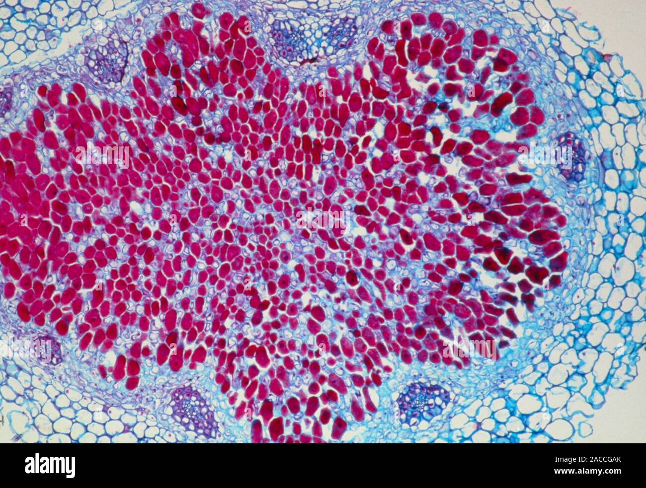 Light micrograph of a root nodule of the broad bean, Vicia faba, a ...