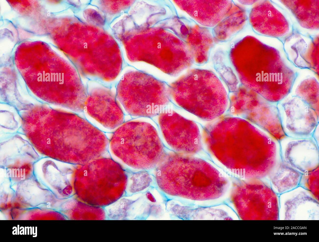 Light micrograph of a root nodule of the broad bean, Vicia faba, a ...