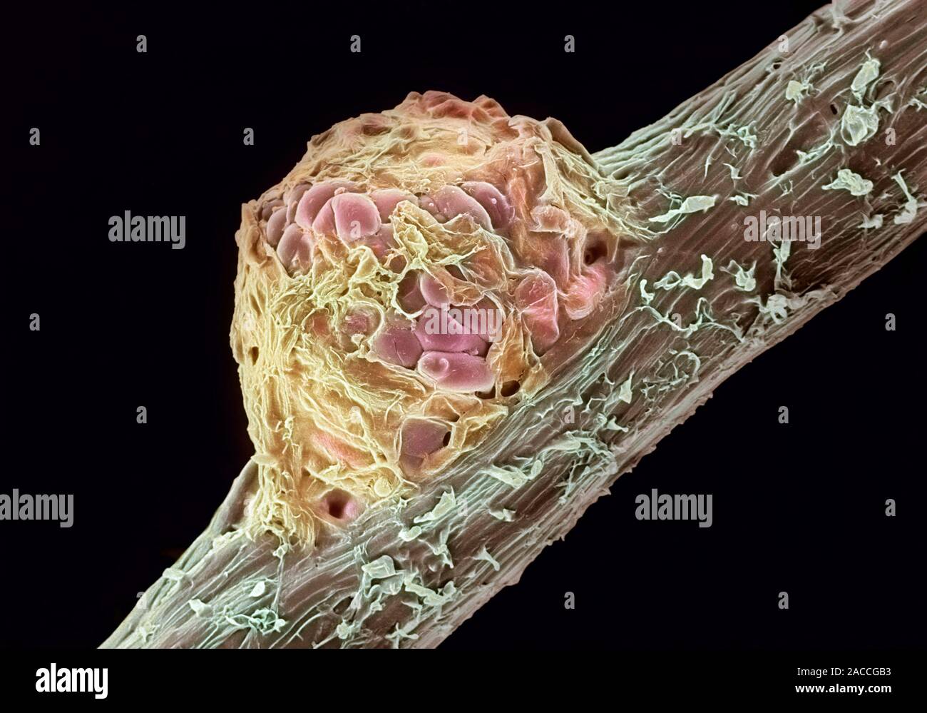 Root nodule. Coloured scanning electron micrograph (SEM) of a root ...