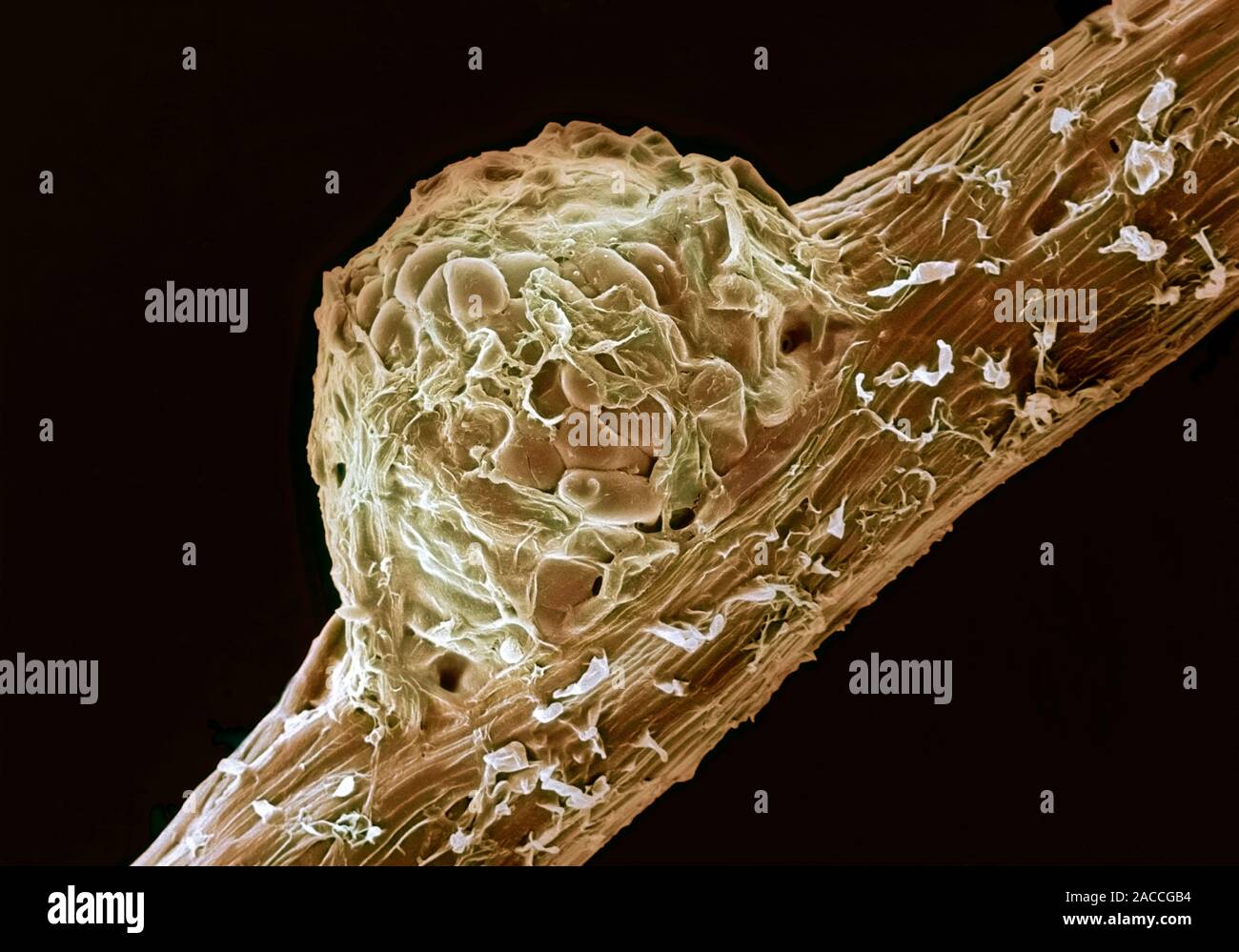 Root Nodule Coloured Scanning Electron Micrograph Sem Of A Root