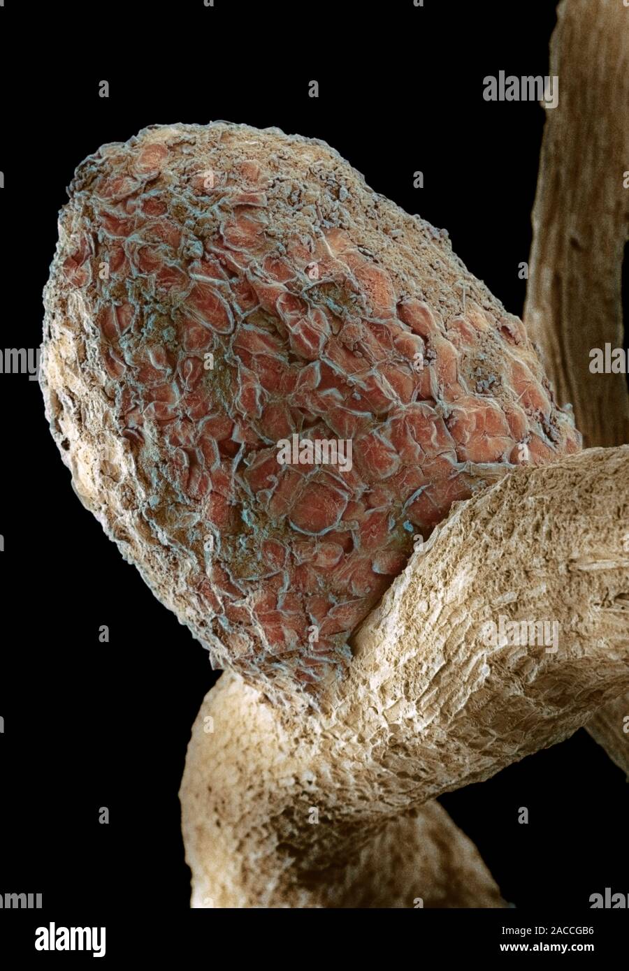 Root Nodule Coloured Scanning Electron Micrograph Sem Of A Root