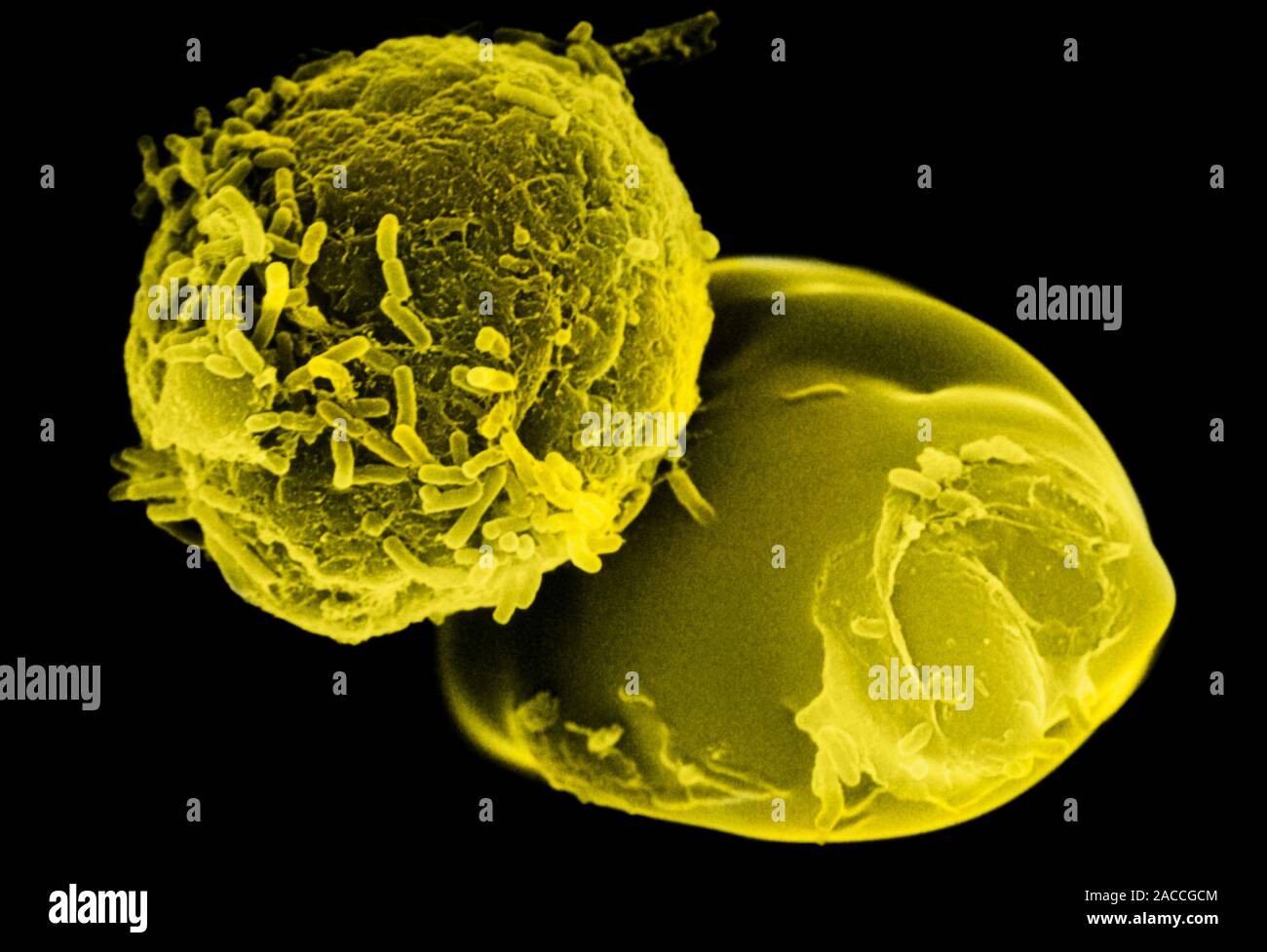 Scanning electron micrograph (SEM), tinted green, of the bacteria ...