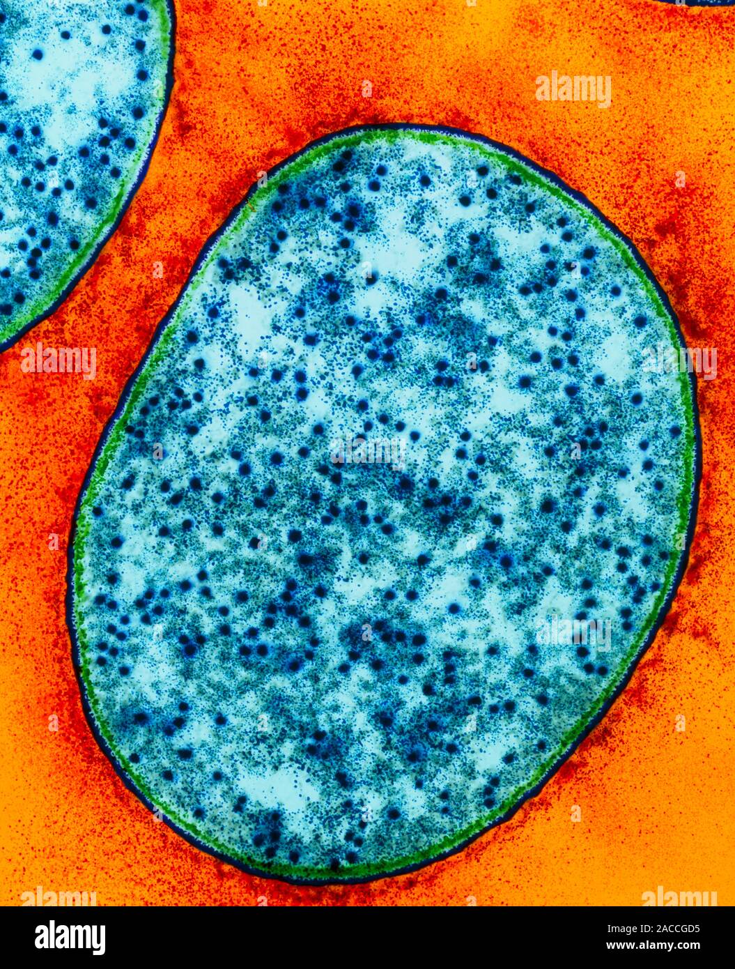 Cold-loving bacterium.Colour transmission electron micrograph (TEM) of ...