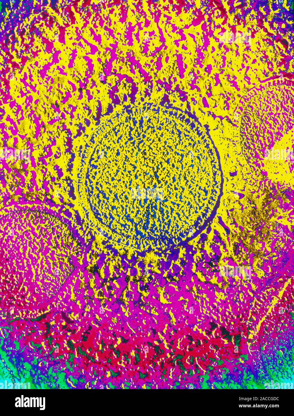 Heat-loving extremophile archaea. Coloured transmission electron ...