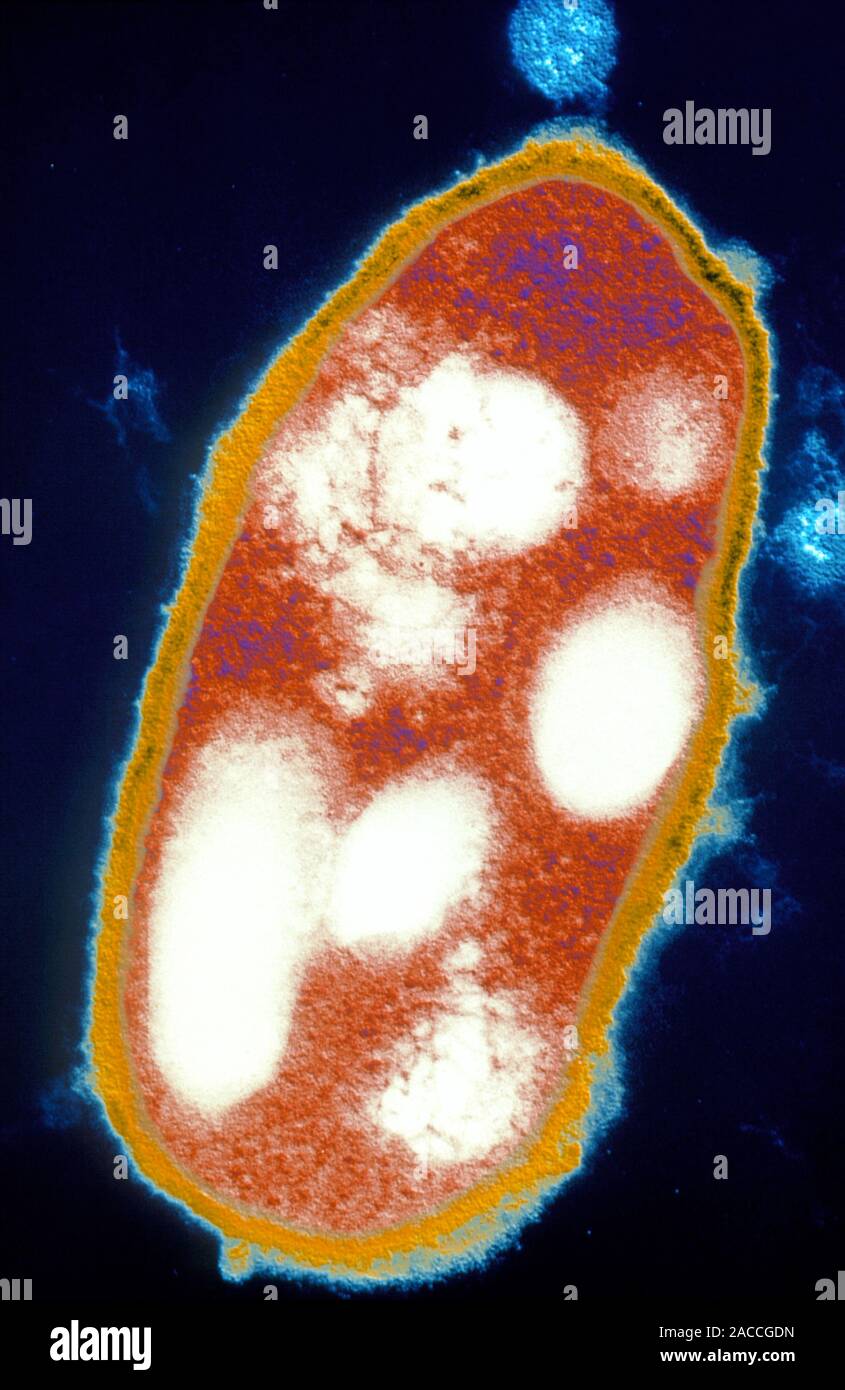 Haloferax mediteranei archaeon. Coloured transmission electron ...