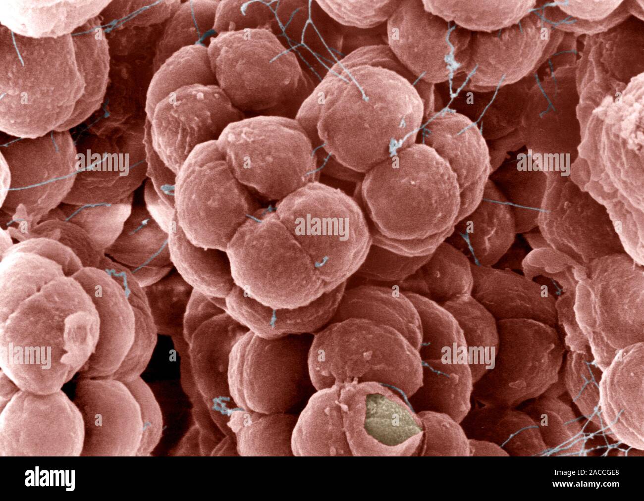 Halococcus archaea. Coloured scanning electron micrograph (SEM) of ...
