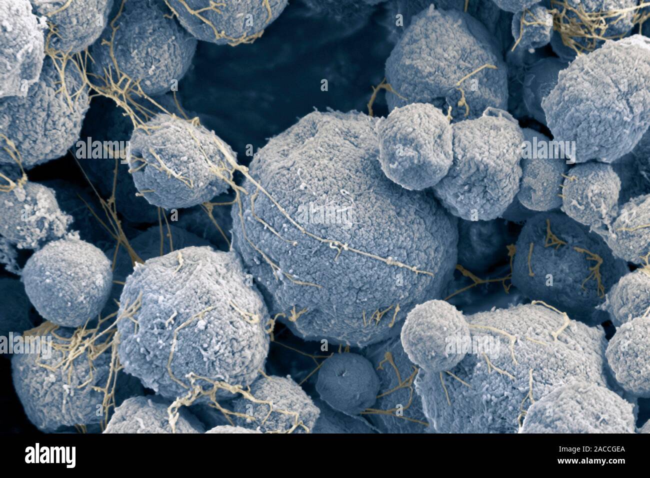 Methanosarcina archaea. Coloured scanning electron micrograph (SEM) of ...
