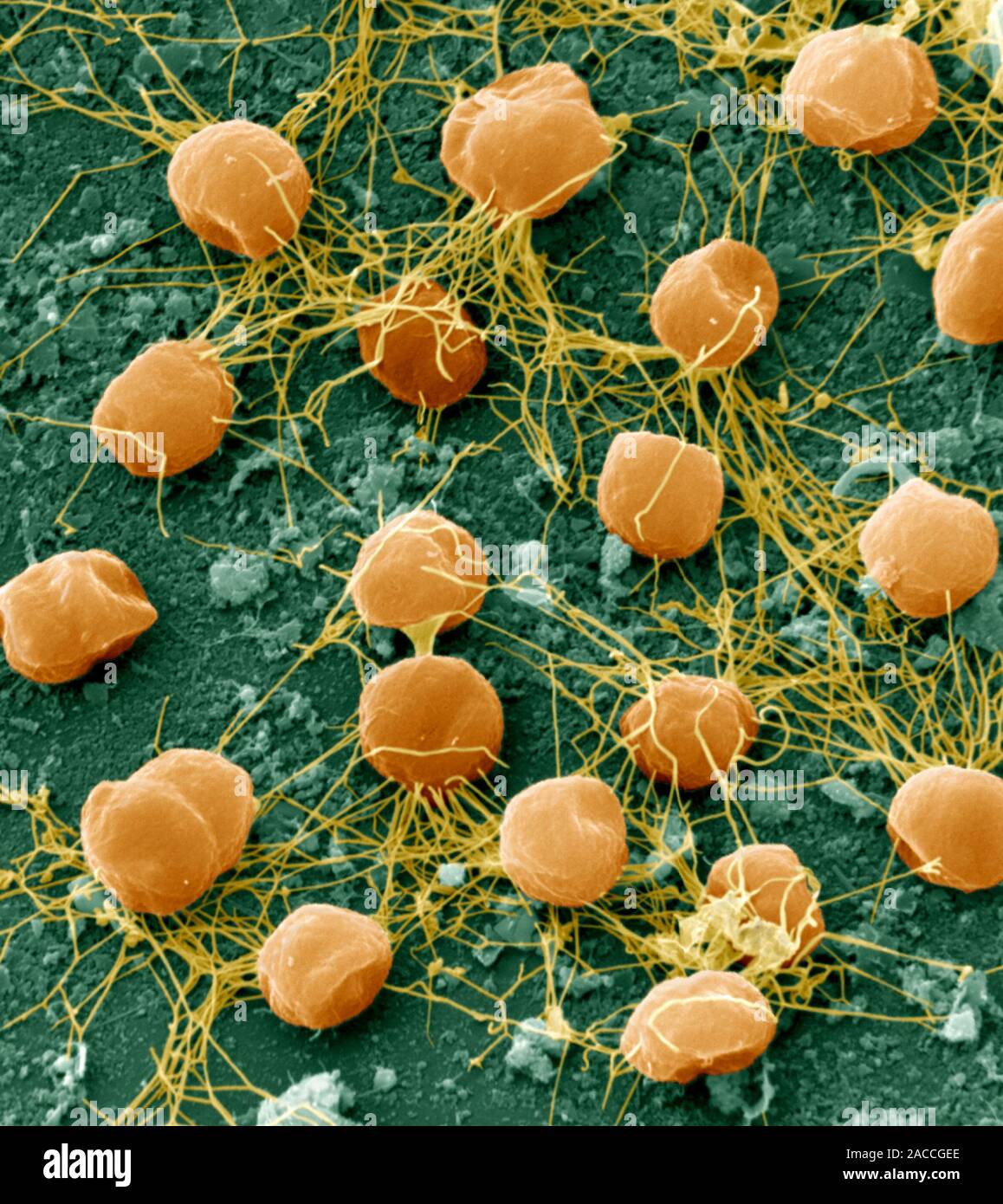 Pyrococcus Furiosus Archaea Coloured Scanning Electron Micrograph Sem