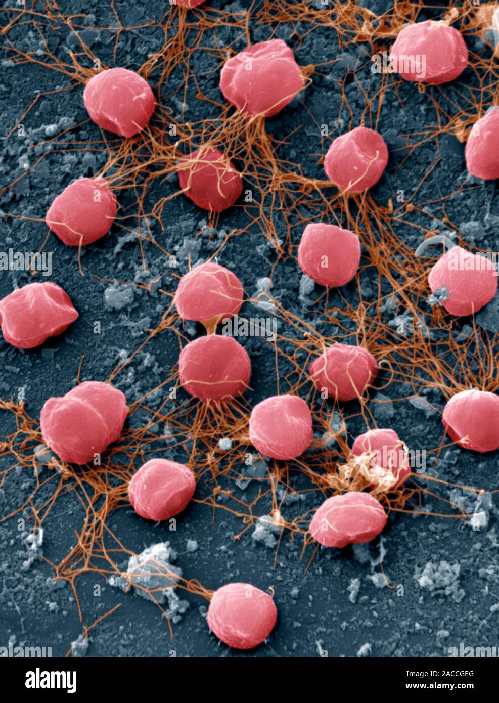 Pyrococcus furiosus archaea, coloured scanning electron micrograph (SEM ...