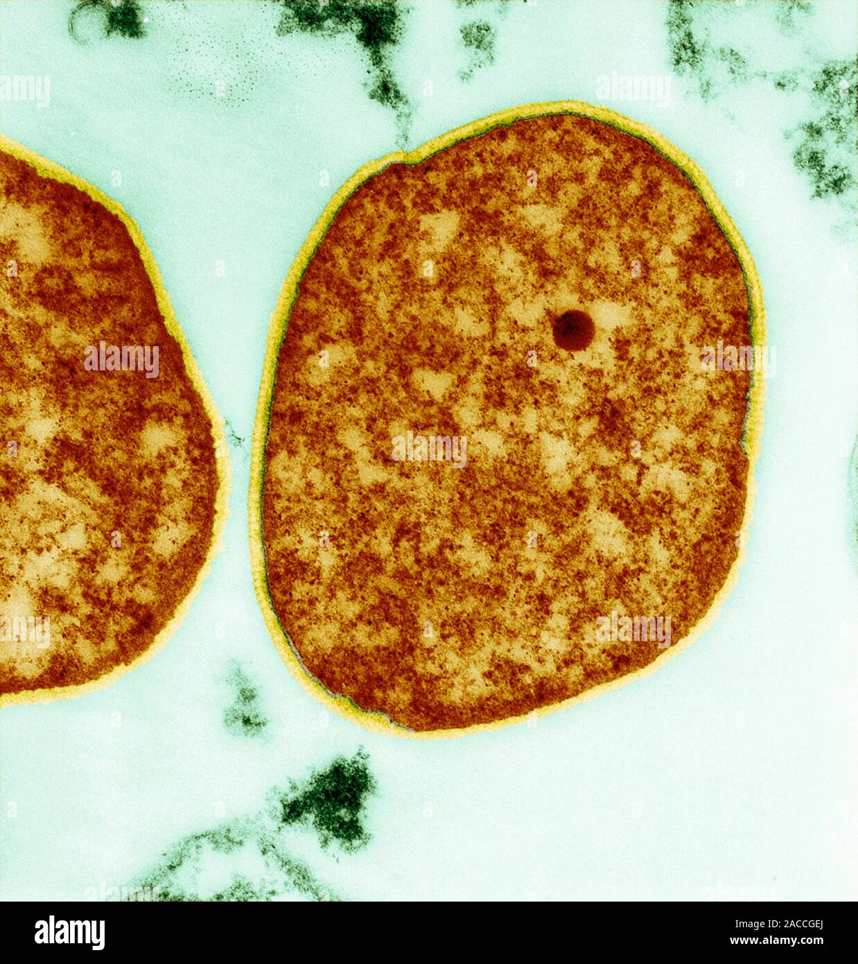 Sulfolobus archaea. Coloured transmission electron micrograph (TEM) of ...