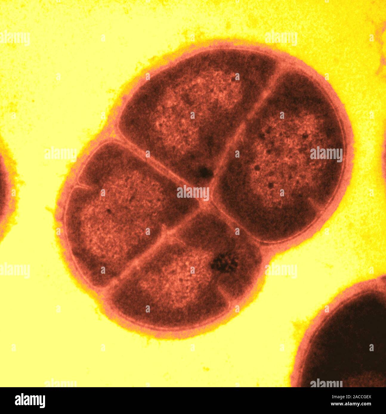 Deinococcus Radiodurans Gram Stain