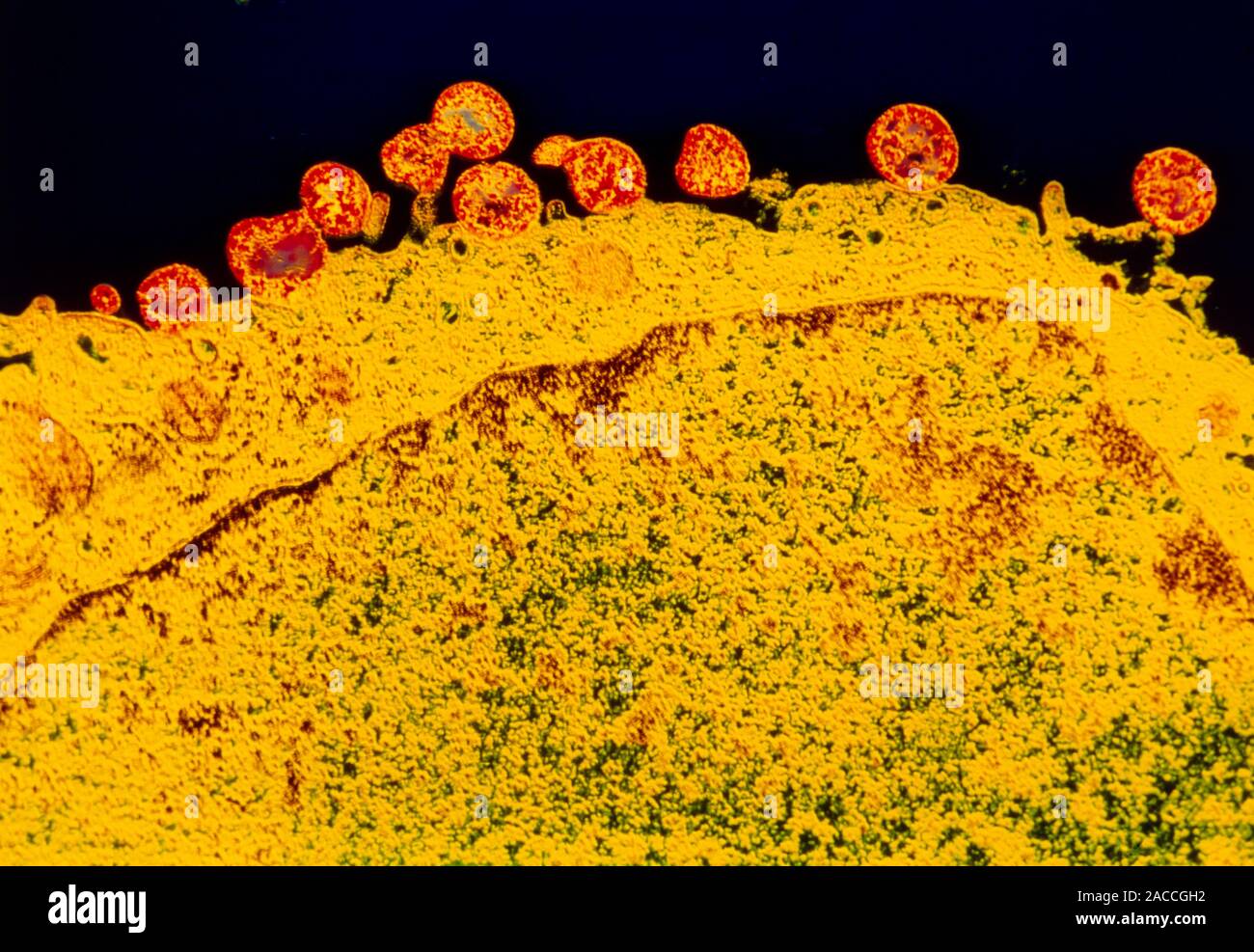 False colour transmission electron micrograph of Mycoplasma sp, (red ...