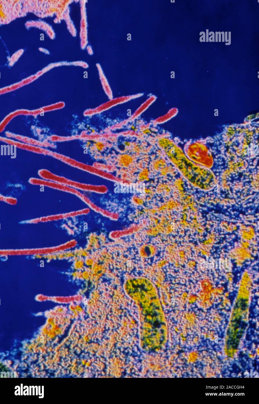 False-colour transmission electron micrograph of numerous individuals ...