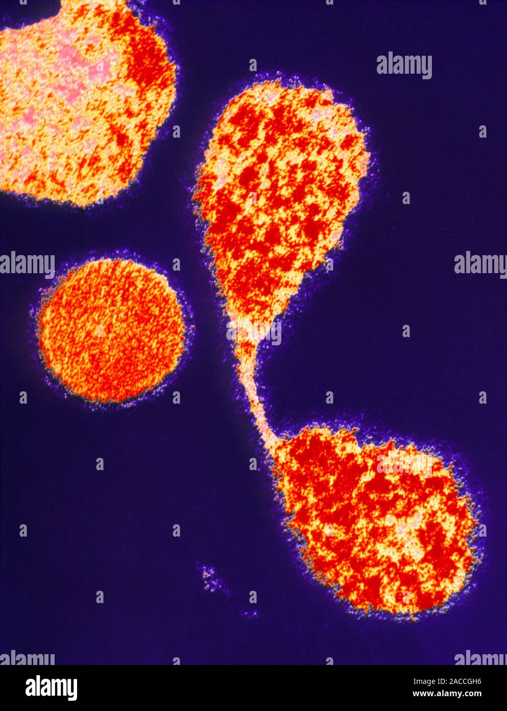 Mycoplasma pneumoniae. Coloured Transmission Electron Micrograph (TEM ...