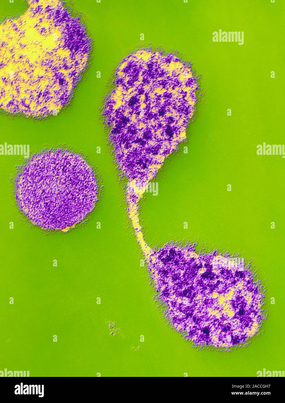 Mycoplasma pneumoniae. Coloured Transmission Electron Micrograph (TEM ...