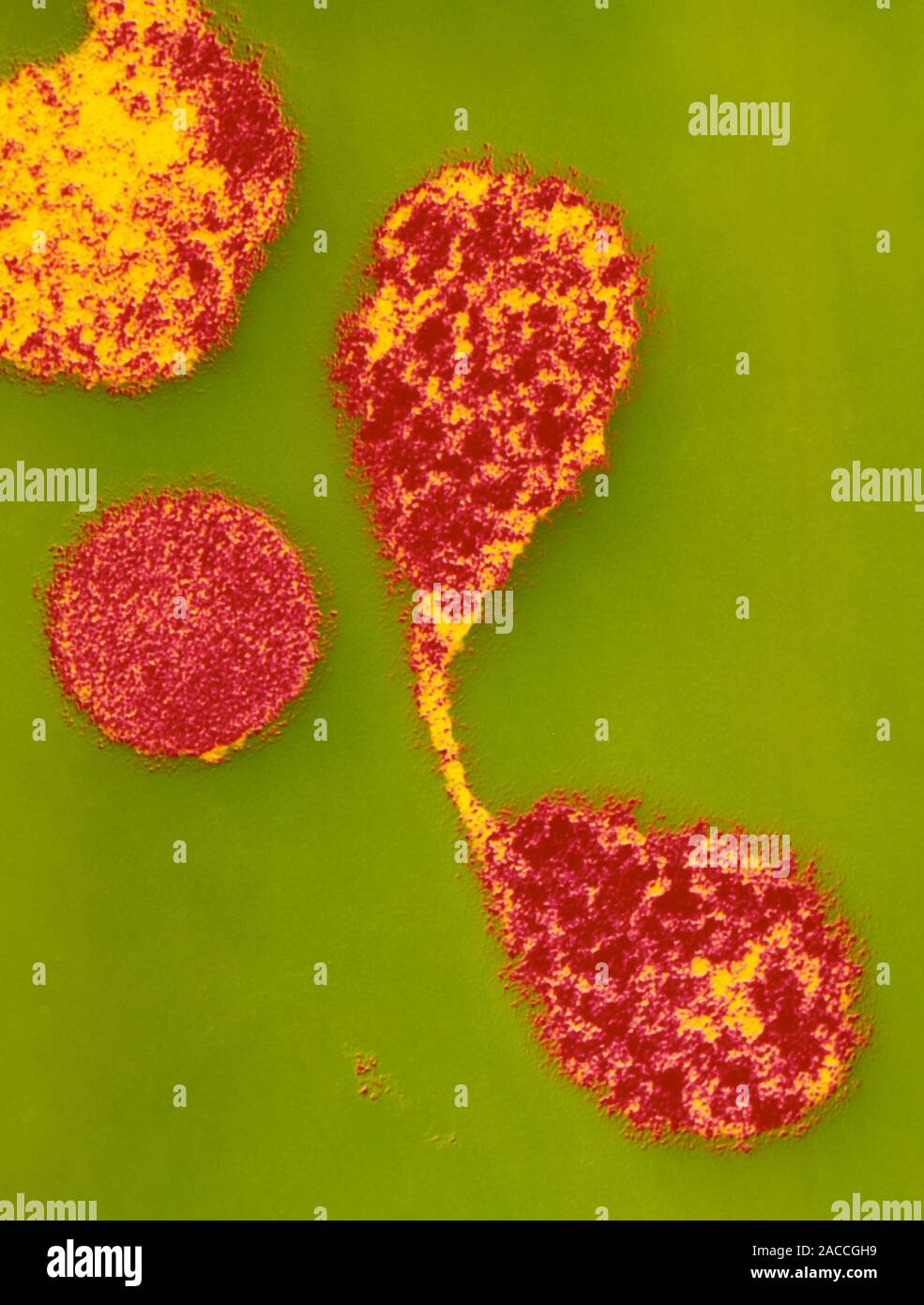 Mycoplasma pneumoniae. Coloured Transmission Electron Micrograph (TEM ...