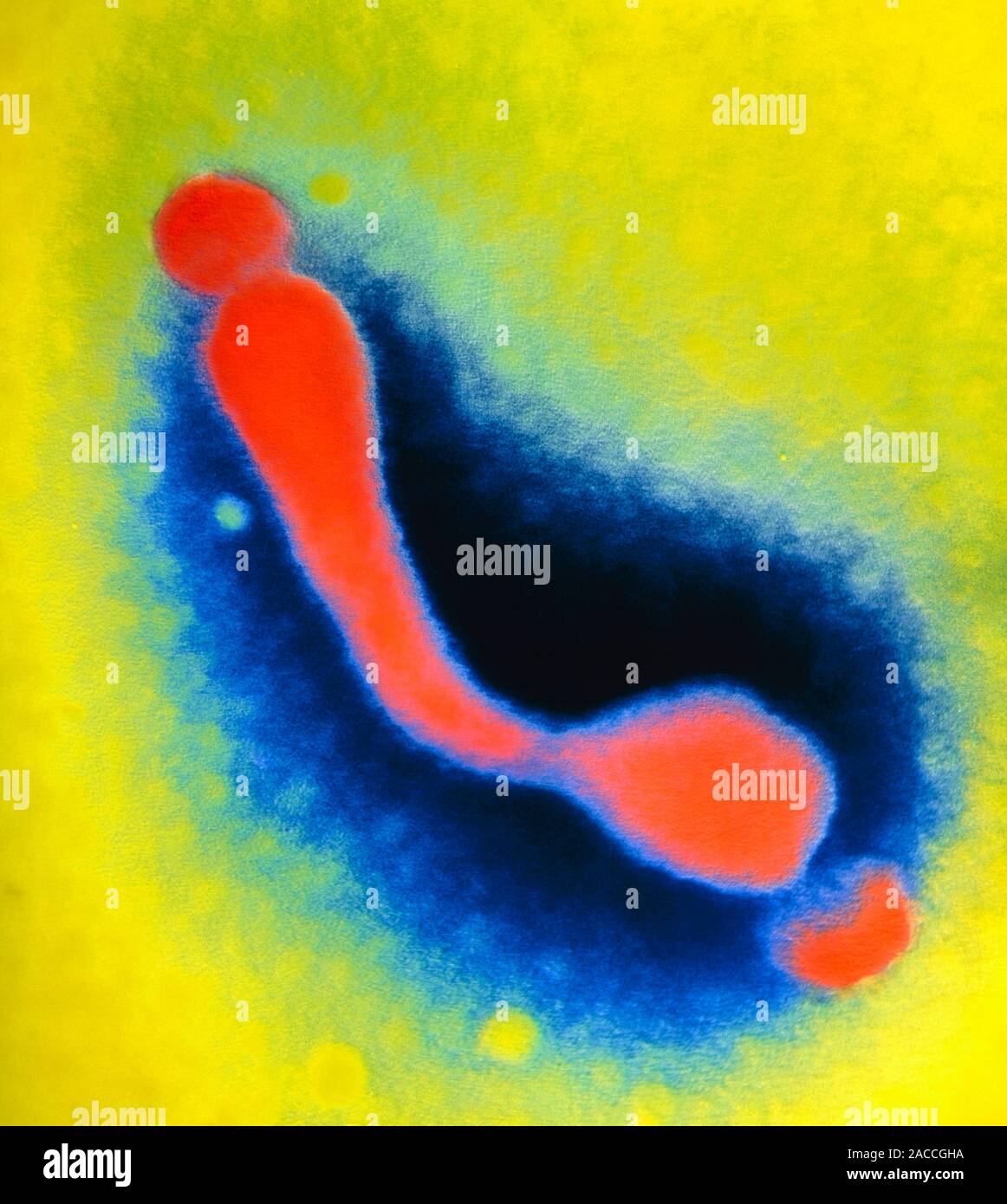 Mycoplasma sp. Coloured Transmission Electron Micrograph of a ...
