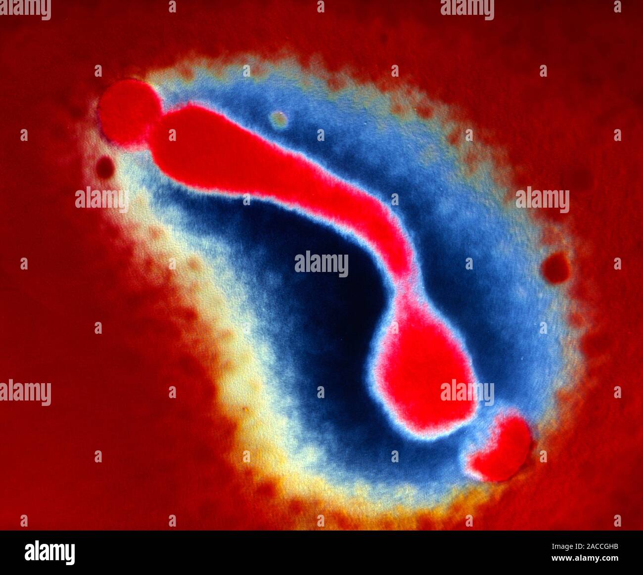 Mycoplasma sp. Coloured Transmission Electron Micrograph of a ...