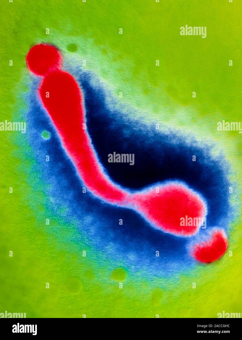 Mycoplasma sp. Coloured Transmission Electron Micrograph of a ...