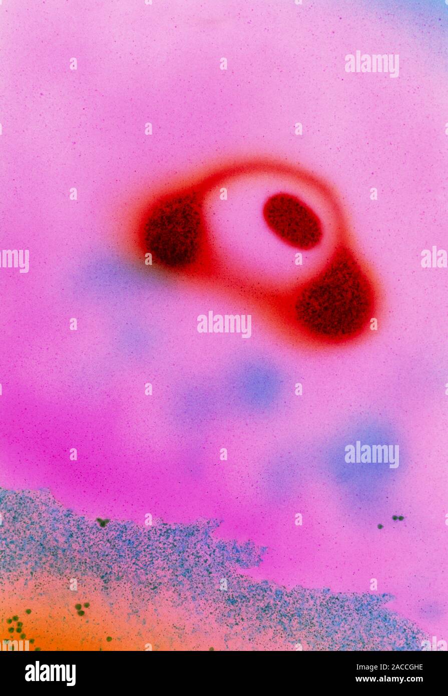 Mycoplasma pneumoniae bacteria. Coloured trans- mission electron ...