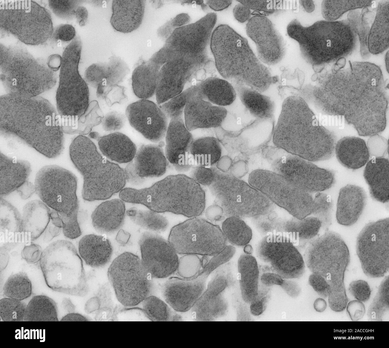 Mycoplasma genitalium, transmission electron micrograph (TEM). M ...
