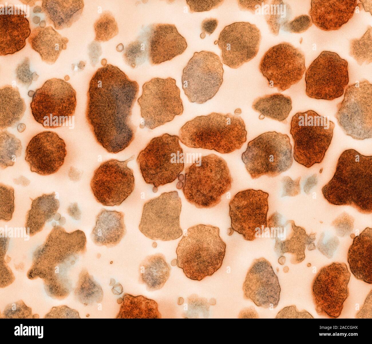 Mycoplasma mycoides bacteria, coloured transmission electron micrograph ...
