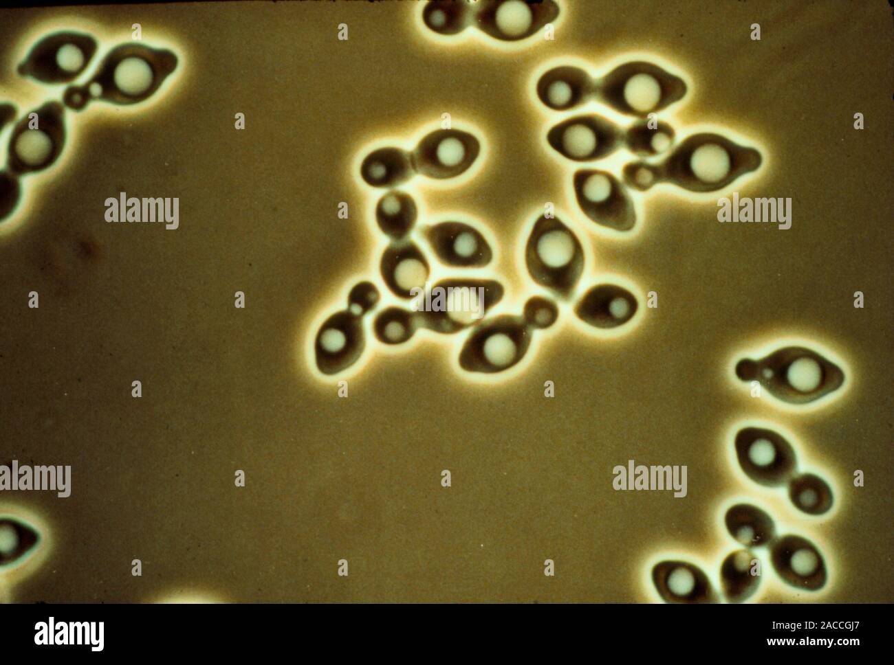 Light micrograph of cells of the yeast, Hanseniaspora nodinigri, some ...