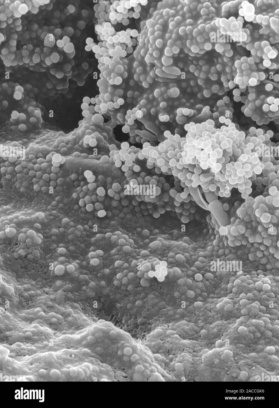 Stilton. Scanning electron micrograph (SEM) of a blue vein in a piece ...