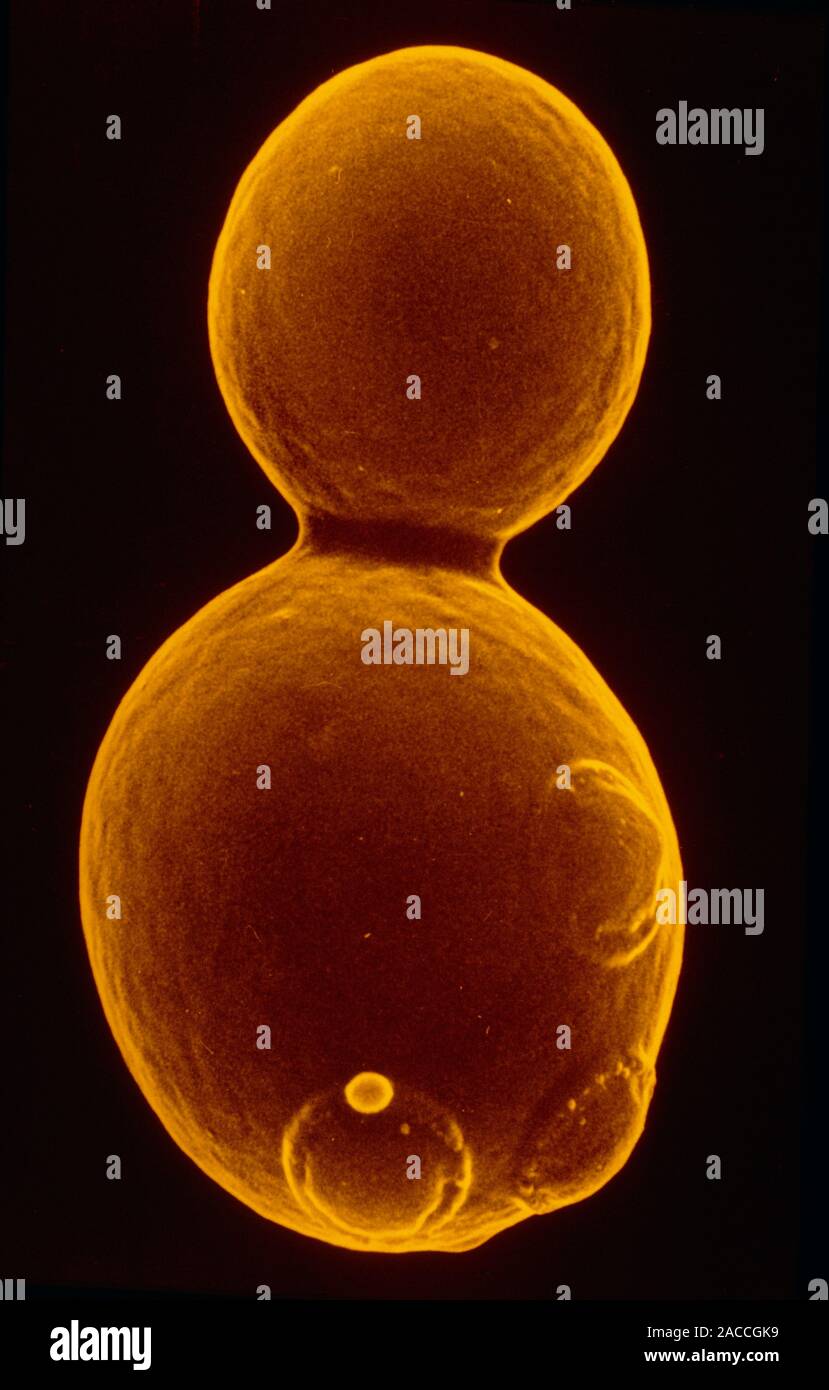 False-colour scanning electron micrograph (SEM) of budding yeast ...