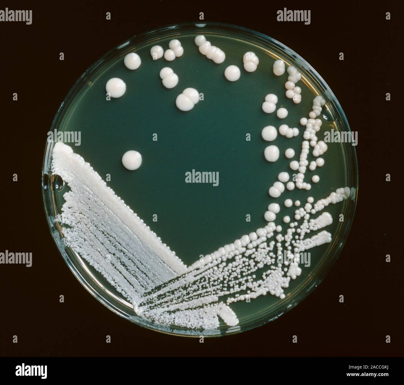 Petri dish culture showing colonies of the yeastlike fungus Torulopsis ...