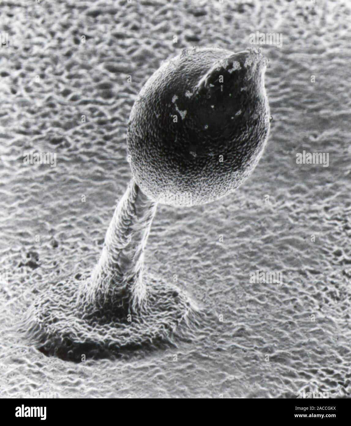 Scanning electron micrograph of a spore tower of the slime mould ...