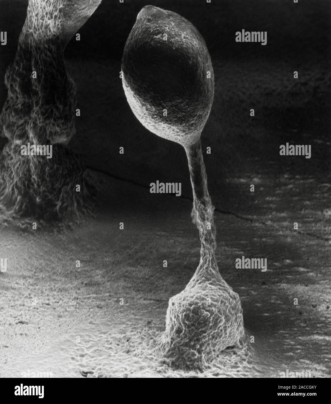 Scanning electron micrograph of a spore tower of the slime mould ...
