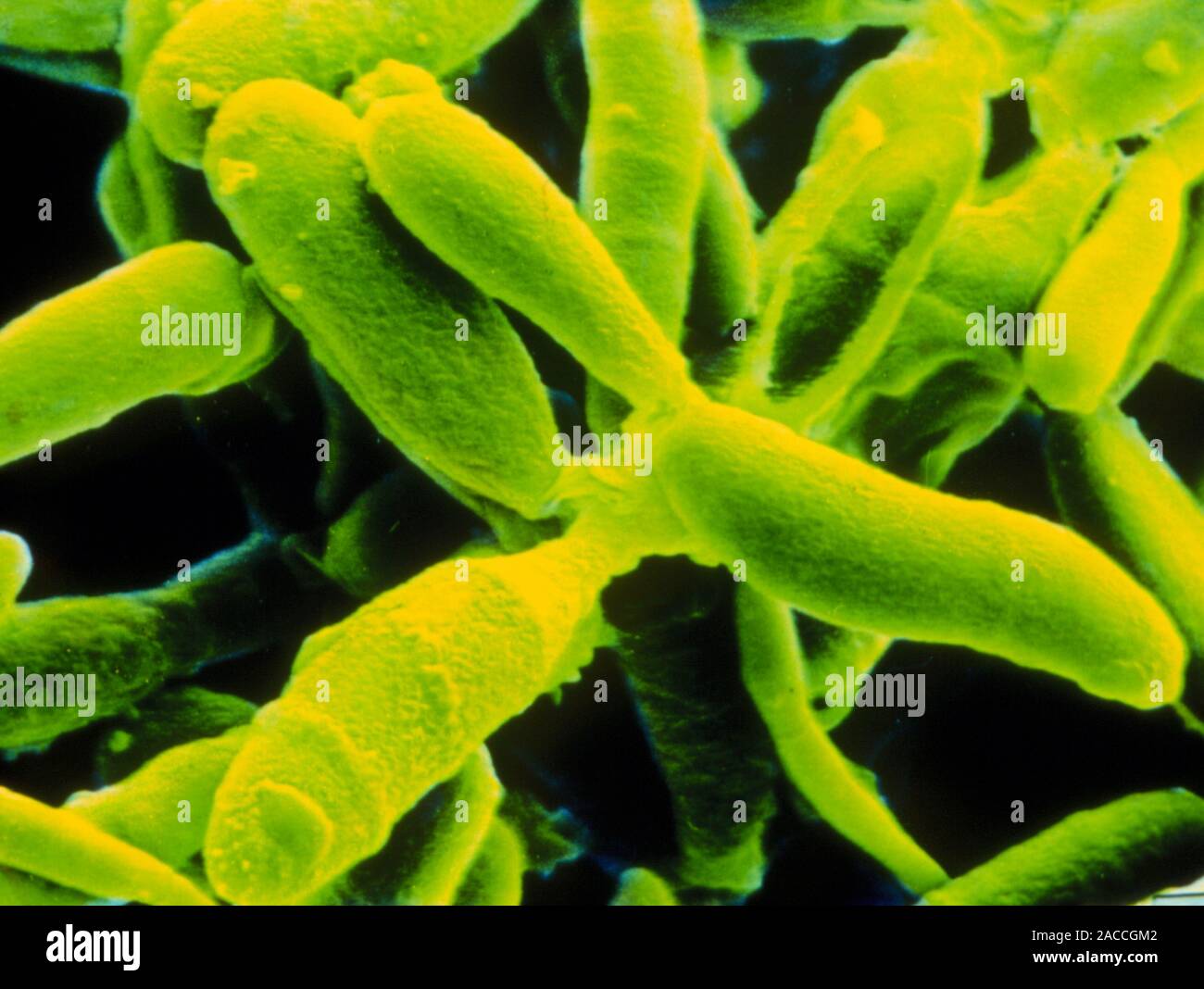 False-colour scanning electron micrograph (SEM) of culture of the ...
