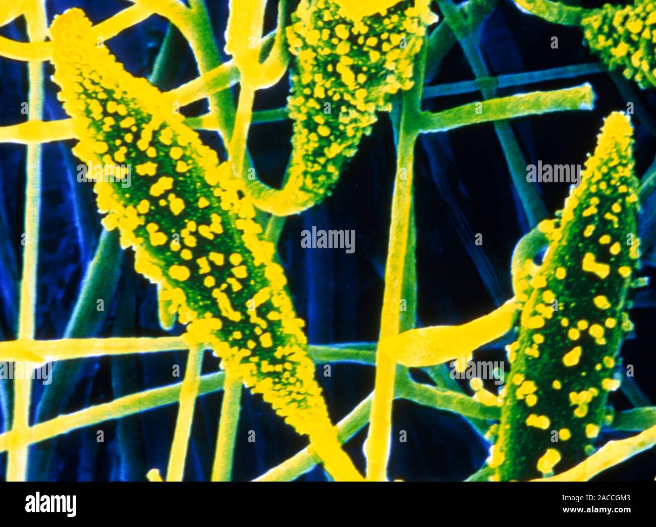 False Colour Scanning Electron Micrograph Sem Of A Culture Of The Dermatophyte Fungus
