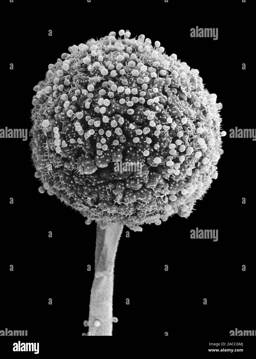Scanning electron micrograph of a sporangium, or fruiting body, of a ...