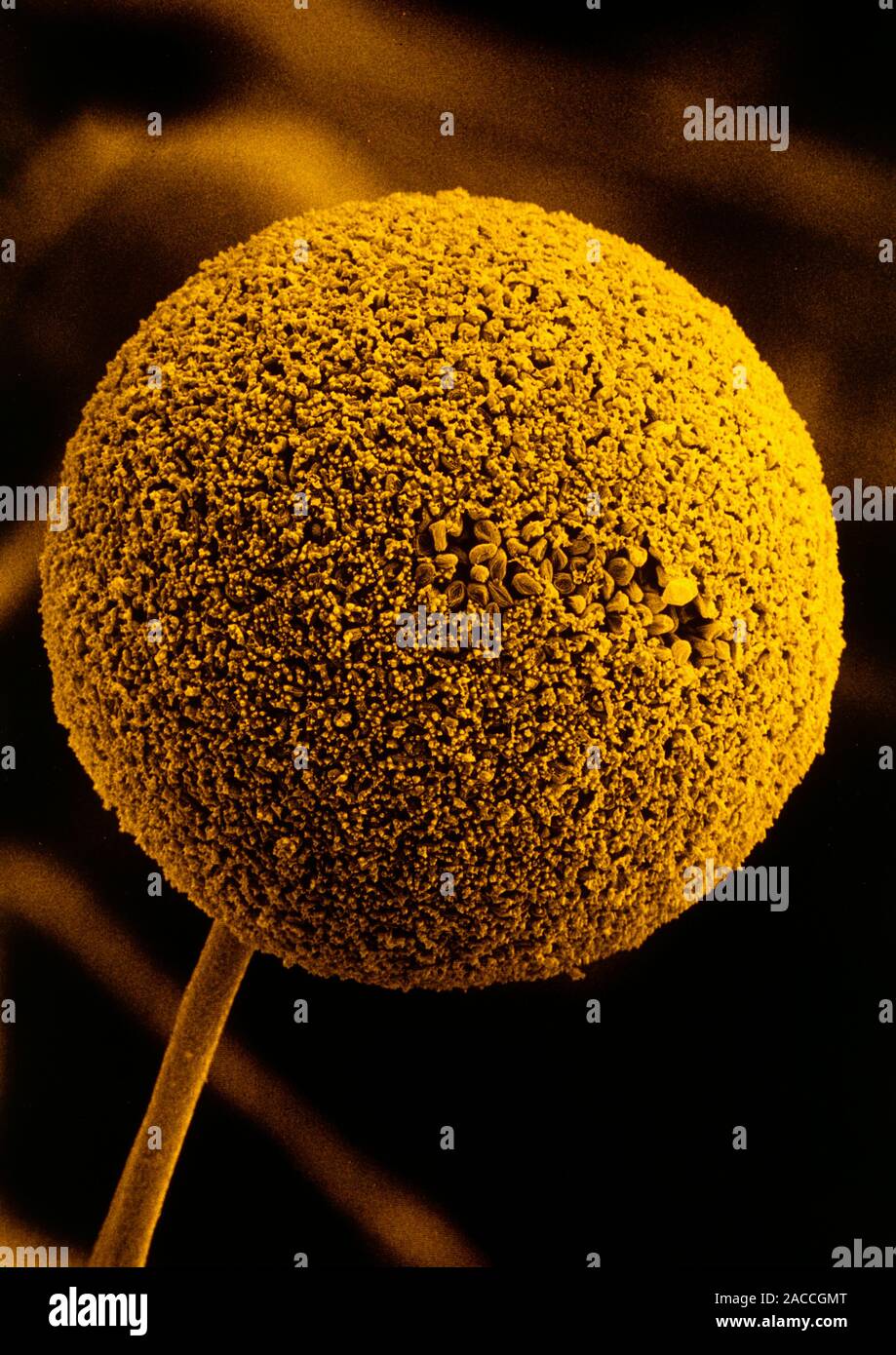 False colour scanning electron micrograph of a sporangium, or fruiting ...