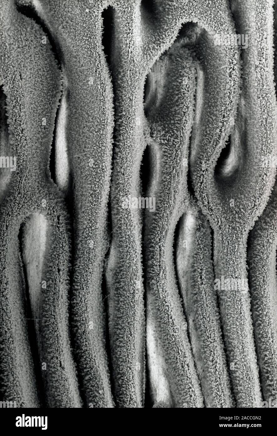 Scanning electron micrograph of the undersurface of a cultivated ...