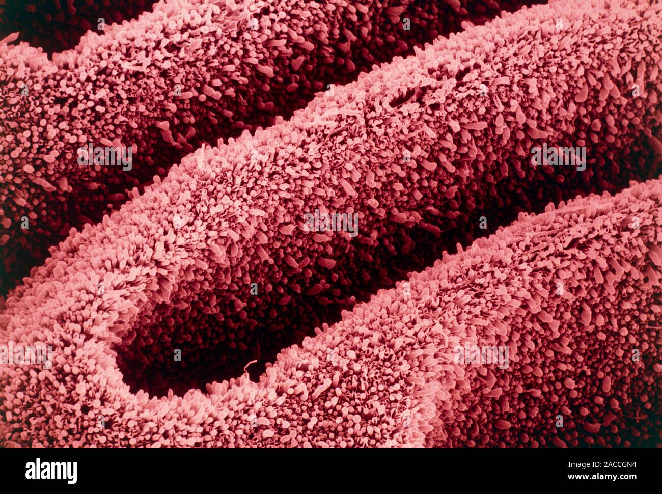 False colour scanning electron micrograph of the undersurface of a ...