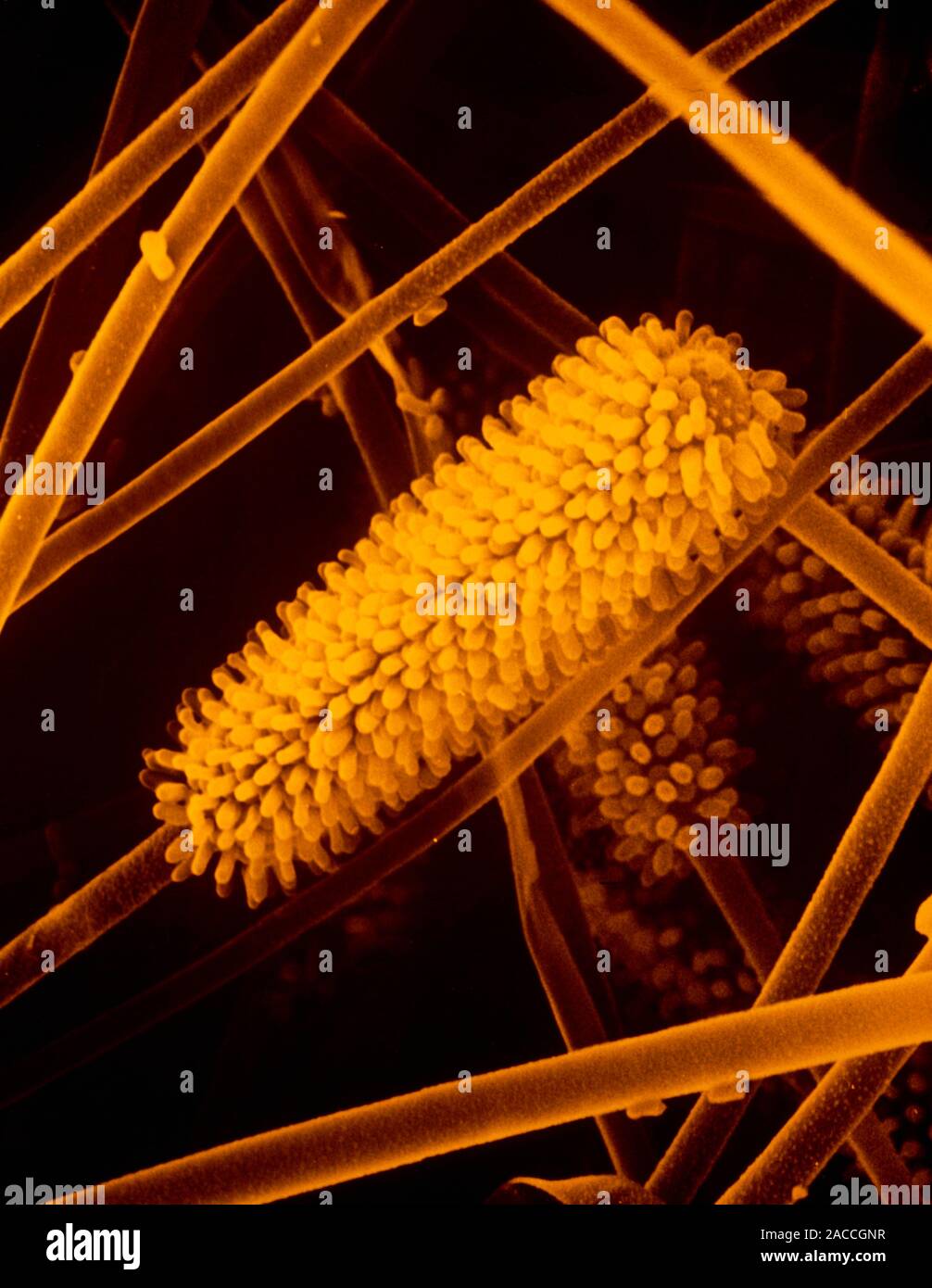 False-colour scanning electron micrograph (SEM) of the spore-bearing ...