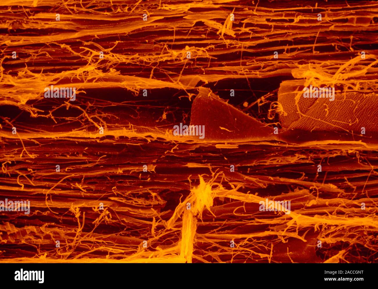Scanning electron micrograph (SEM) of dry rot in a piece of domestic ...